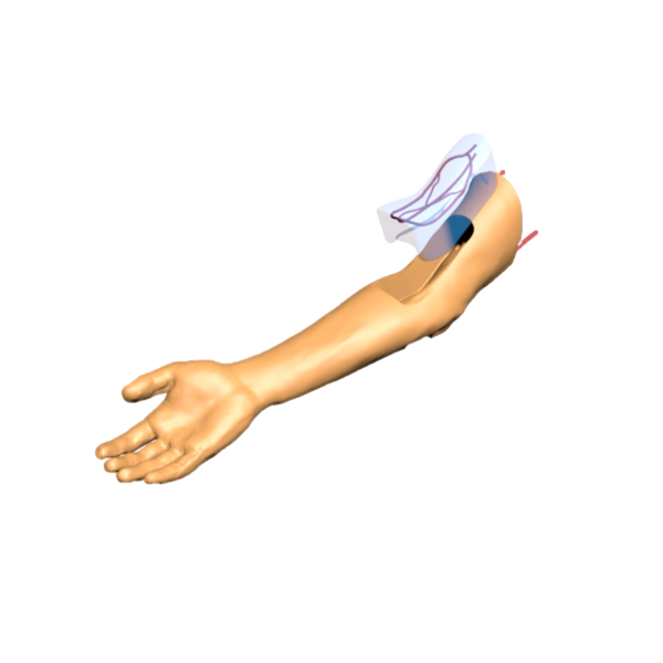 Arm Phantom – Gamma Gurus