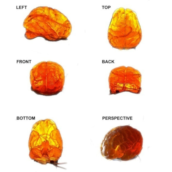 Brain Phantom – Gamma Gurus
