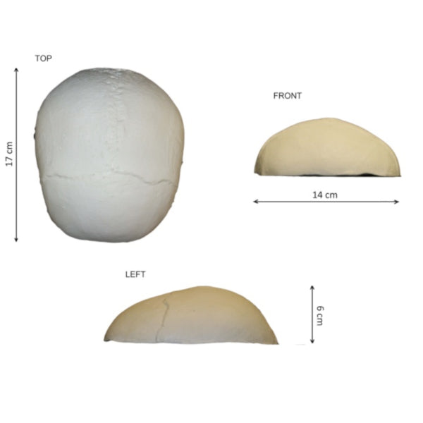 Calvaria Phantom – Gamma Gurus