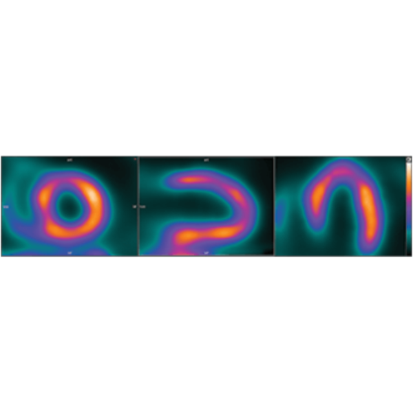 MIMcardiac® – Gamma Gurus