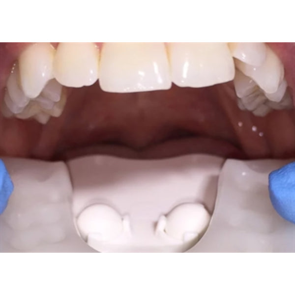 GrayDuck Stents™ – Gamma Gurus